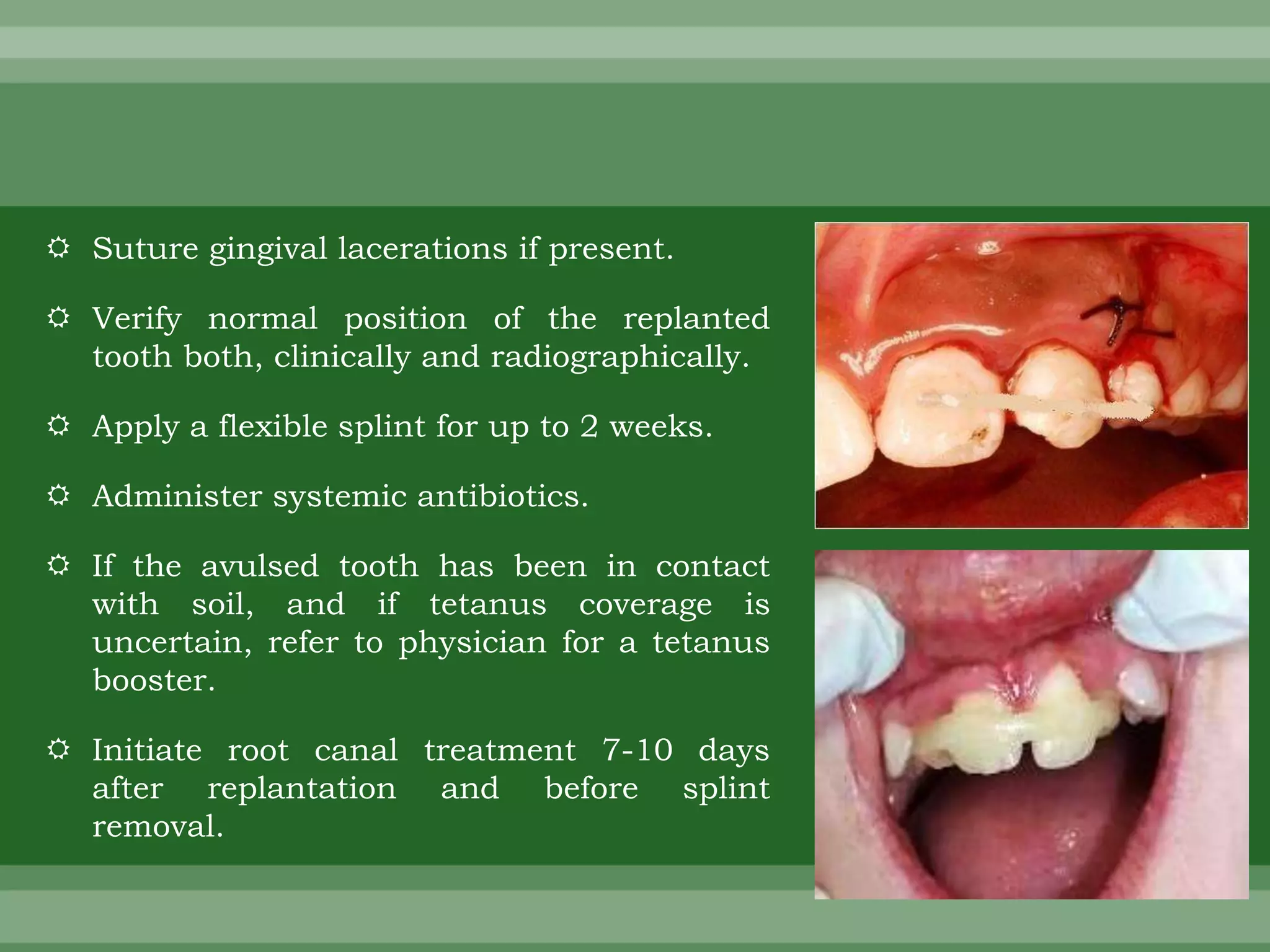 DR SHAKIR Traumatic injuries of teeth in children | PPTX | Dental ...