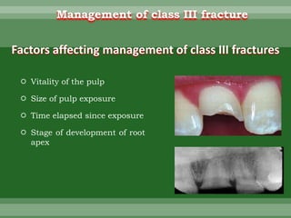 DR SHAKIR Traumatic injuries of teeth in children | PPTX | Dental ...