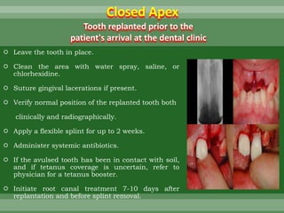 DR SHAKIR Traumatic injuries of teeth in children | PPTX