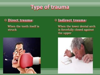DR SHAKIR Traumatic injuries of teeth in children | PPTX | Dental ...
