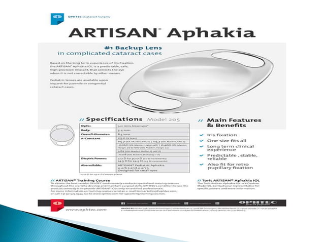 traumatic lens subluxation what to know | PPT