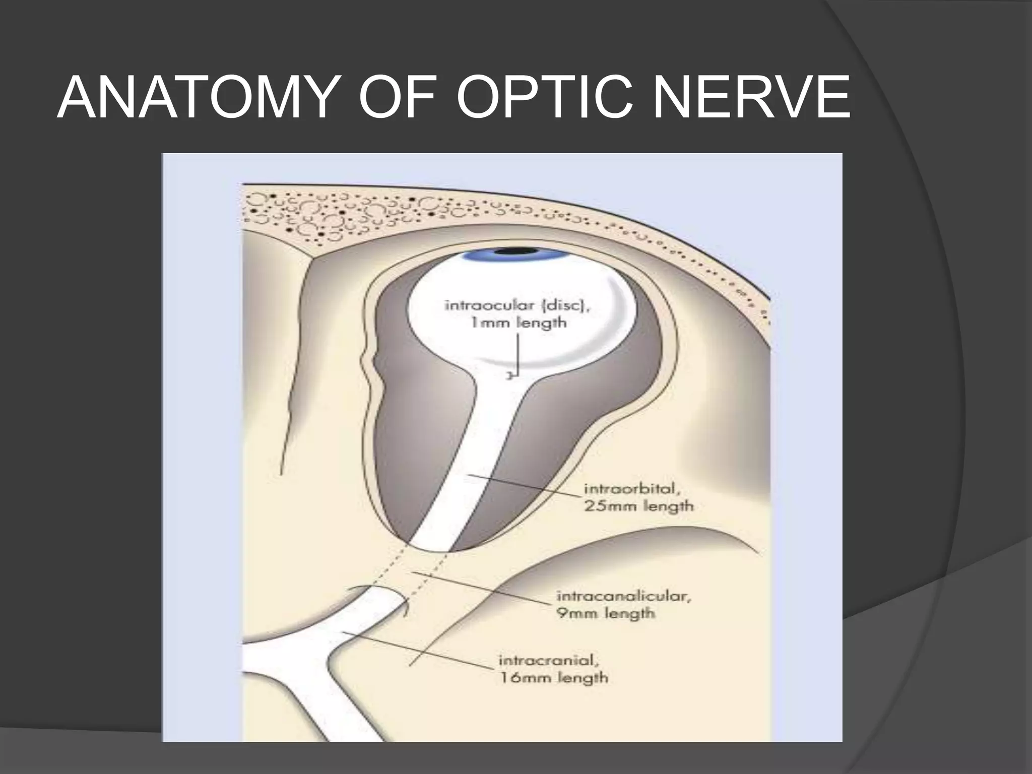 Traumatic optic neuropathy | PPTX