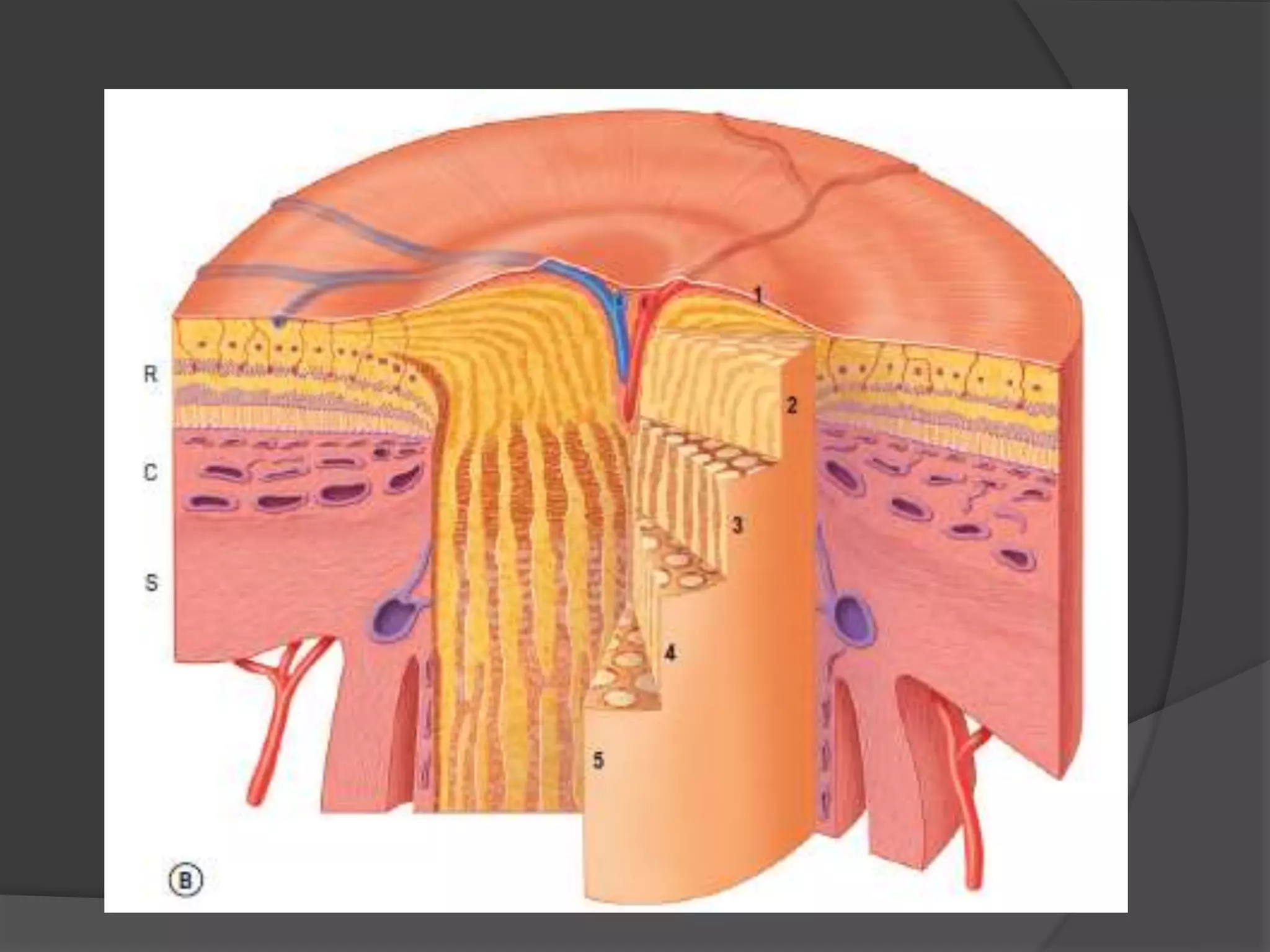 Traumatic optic neuropathy | PPTX