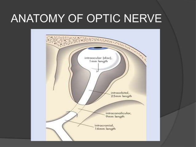 Traumatic optic neuropathy | PPTX