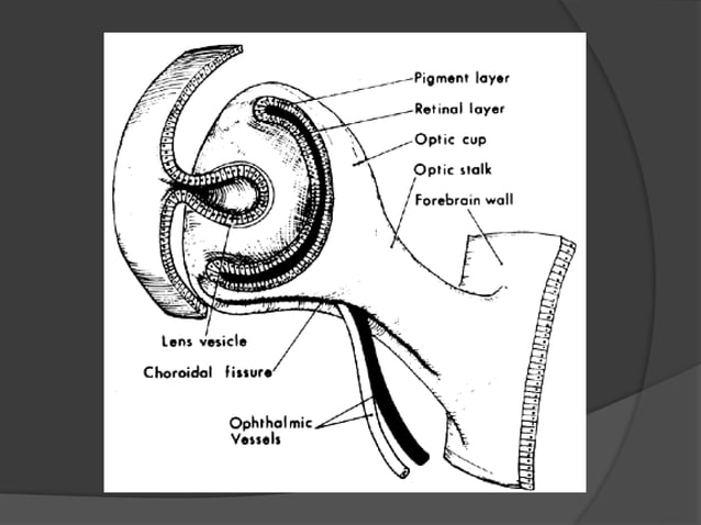 Traumatic optic neuropathy | PPTX
