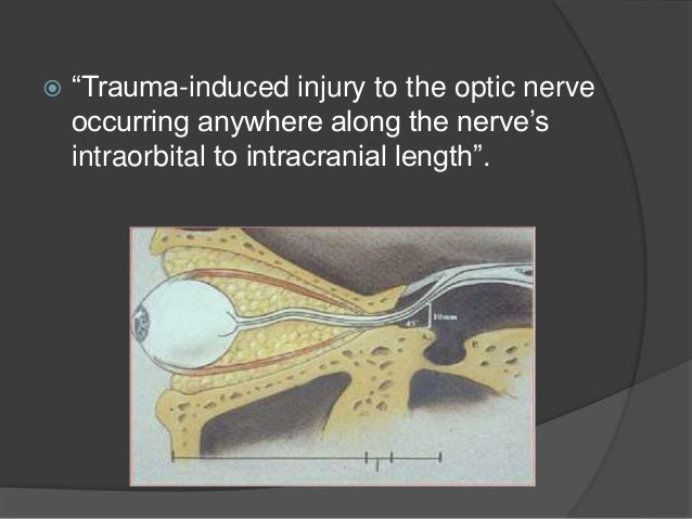 Traumatic optic neuropathy