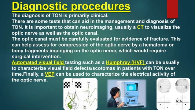 Traumatic optic neuropathy | PPTX