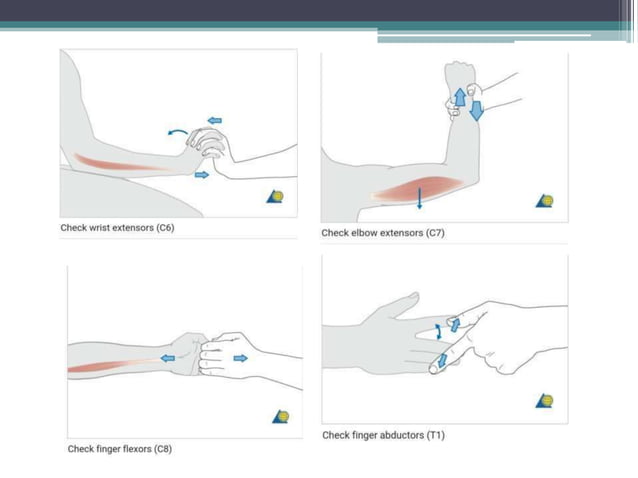 Traumatic paraplegia & bladder management by dr ashutosh | PPTX