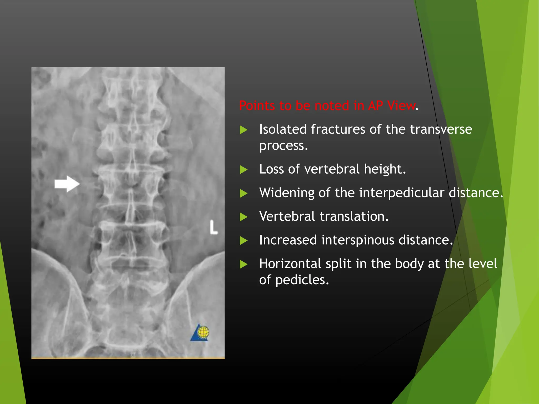 TRAUMATIC PARAPLEGIA PPT dr.bharti pawar .pptx