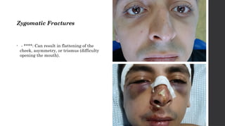 correction of different facial deformities.pptx