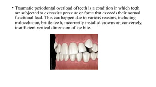Traumatic periodontal overload-1.pptxppt | PPT