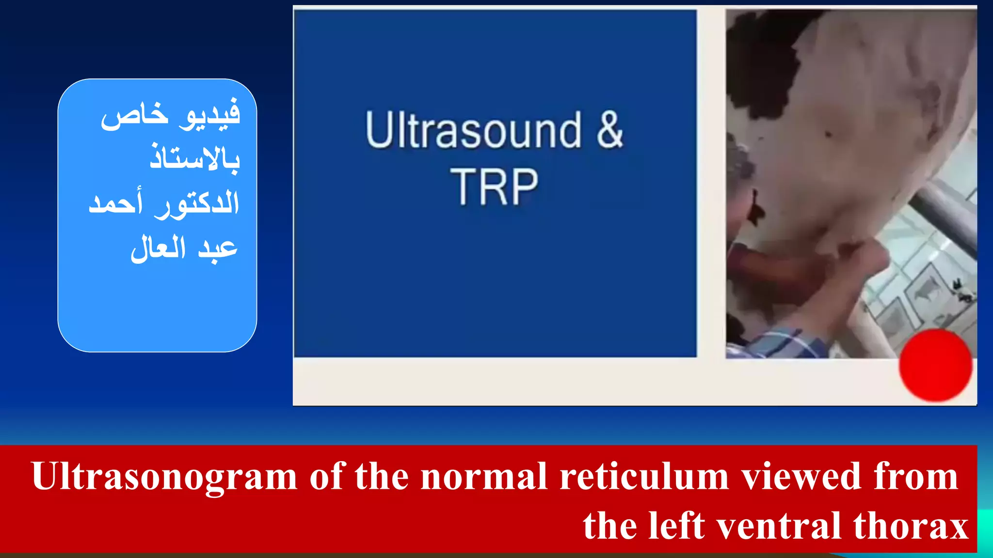 Traumatic reticulo peritonitis | PDF