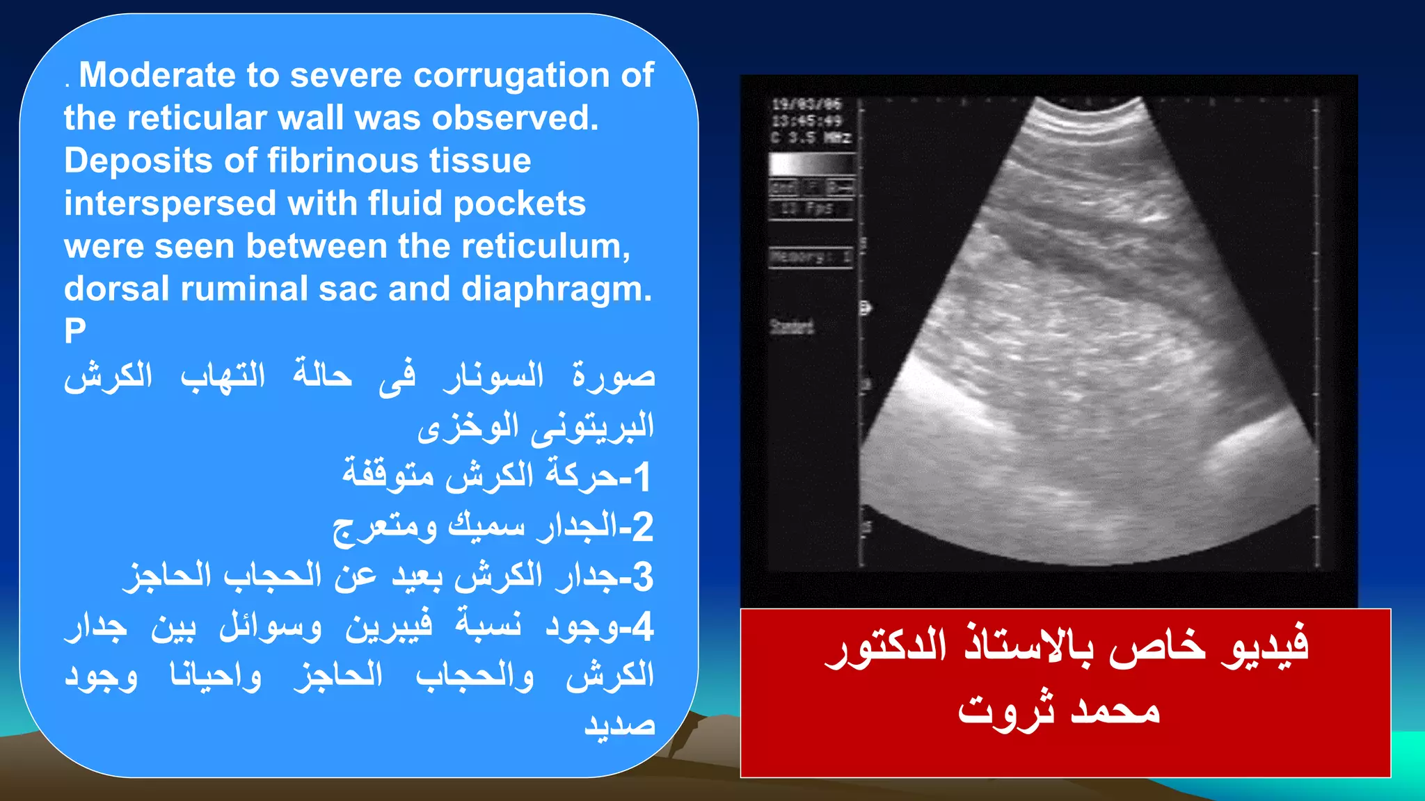 Traumatic reticulo peritonitis | PDF