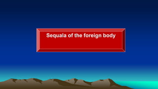 Traumatic reticulo peritonitis | PDF