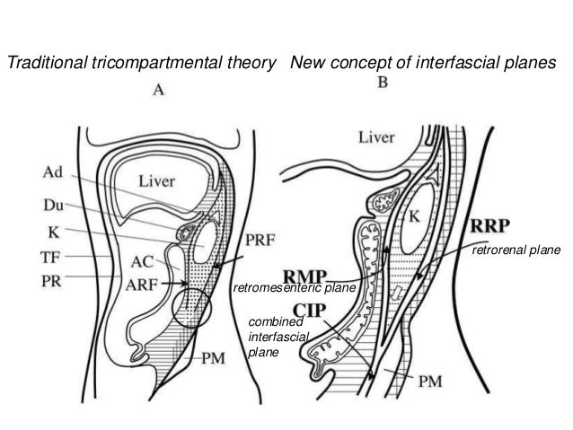 Traumatic Retroperitoneal Hematoma