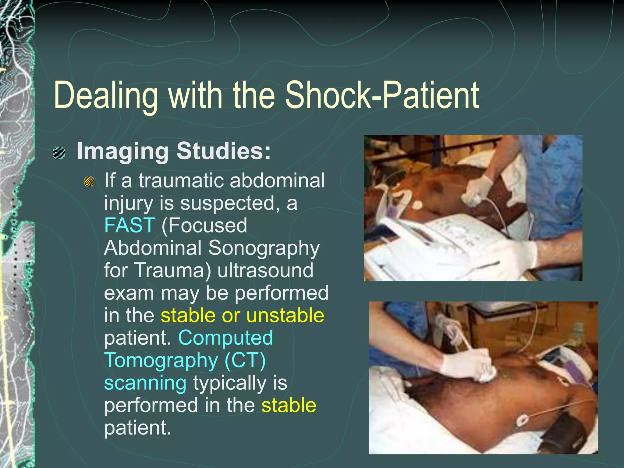 Traumatic shock.ppt