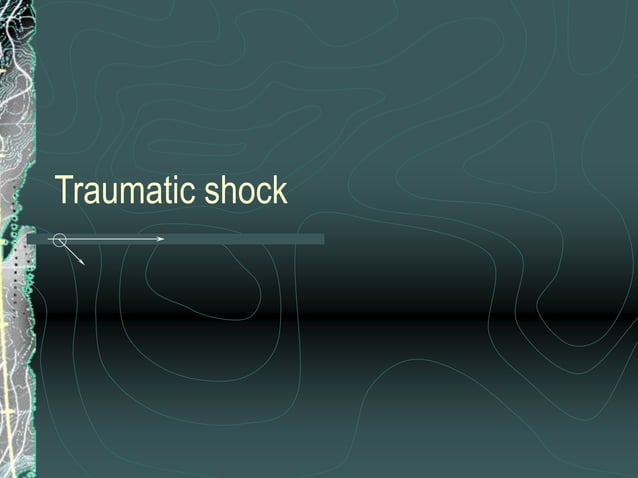 Traumatic shock.ppt