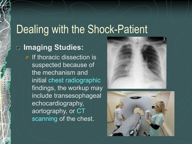Traumatic shock.ppt