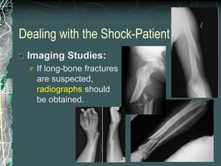 Traumatic shock.ppt