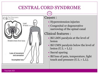 Traumatic spinal cord injury | PPT