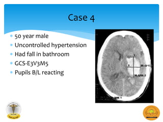Traumatic versus Non-Traumatic Intracerebral (Intracranial) Bleeds | PPTX