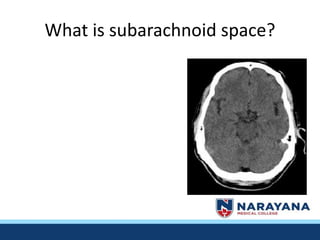 Traumatic Vs Spontaneous Subarachnoid Hemorrhage (SAH) | PPTX