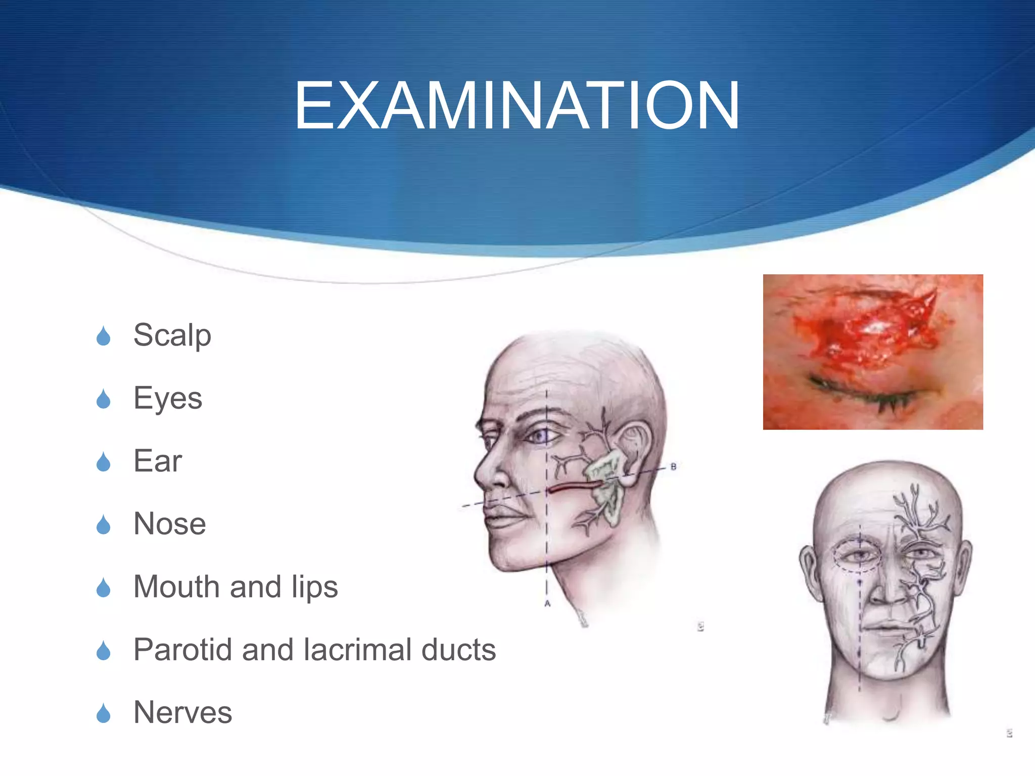 Traumatic wounds in MaxFac | PPTX