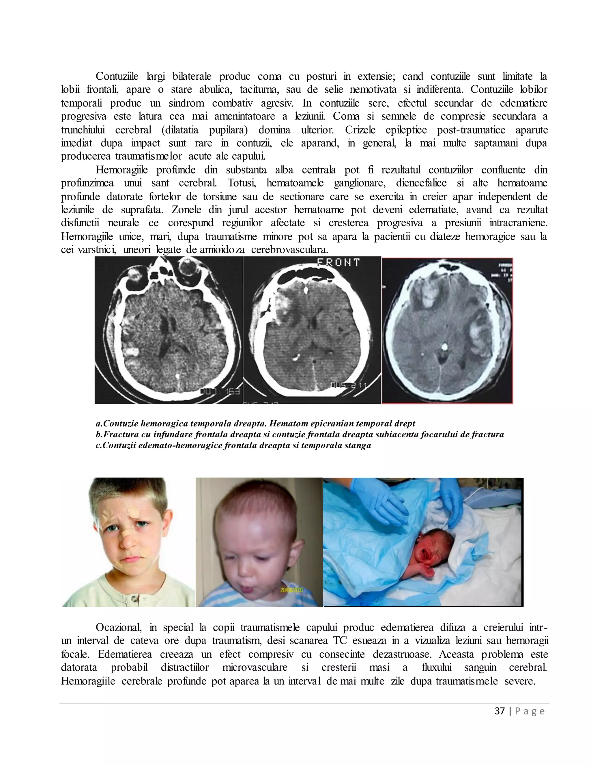 Traumatismele craniocerebrale si vertebromedulare | PDF
