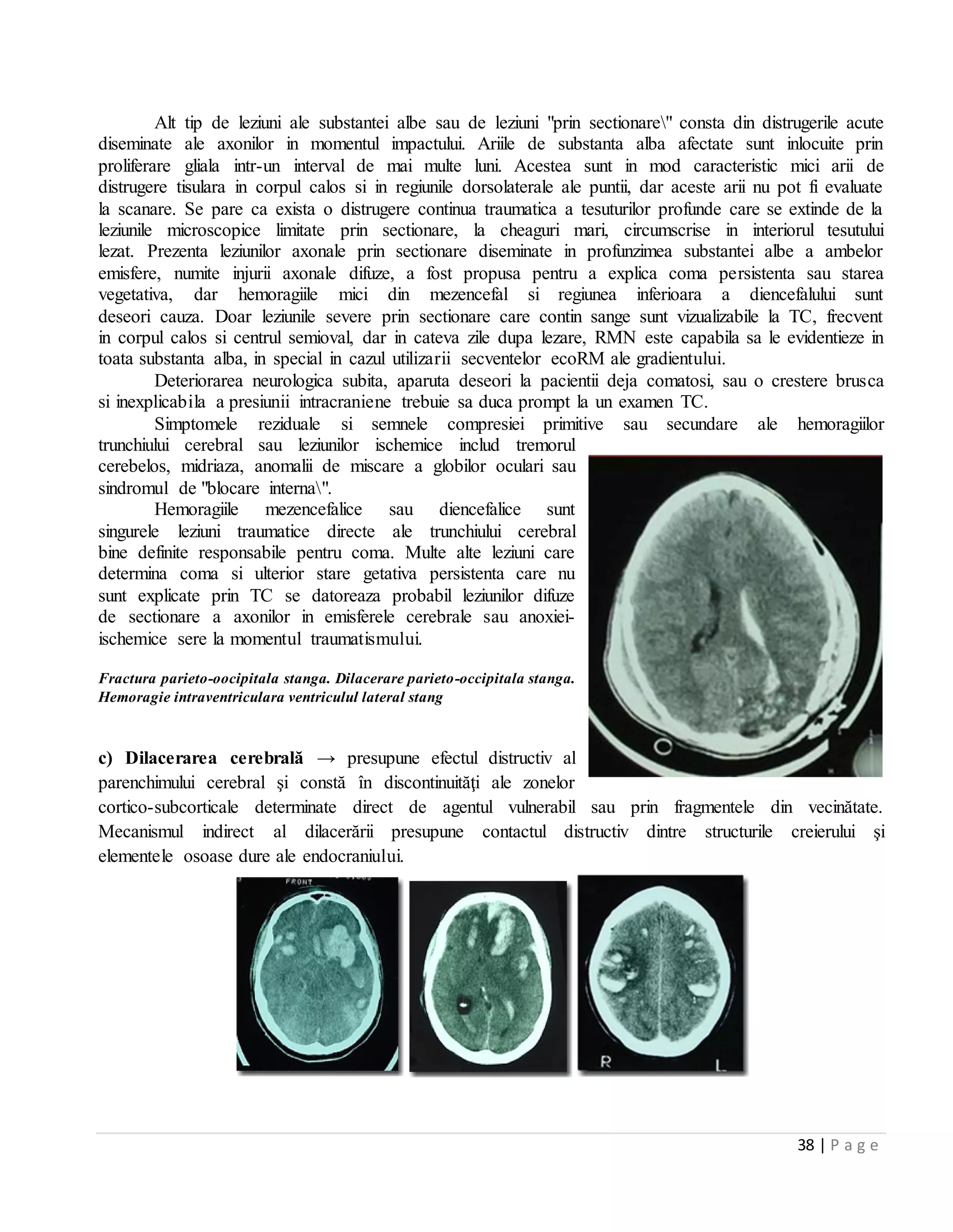 Traumatismele craniocerebrale si vertebromedulare | PDF