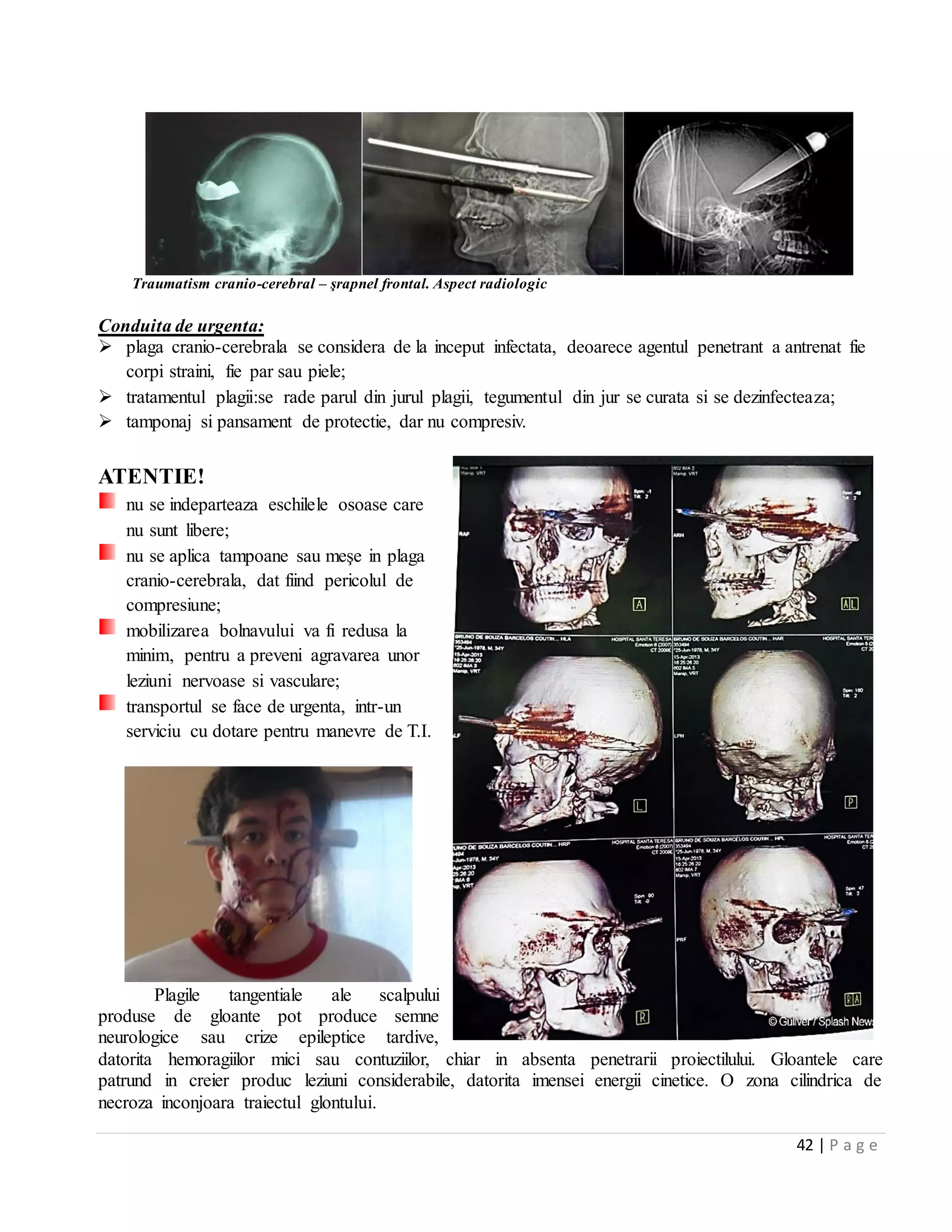 Traumatismele craniocerebrale si vertebromedulare | PDF