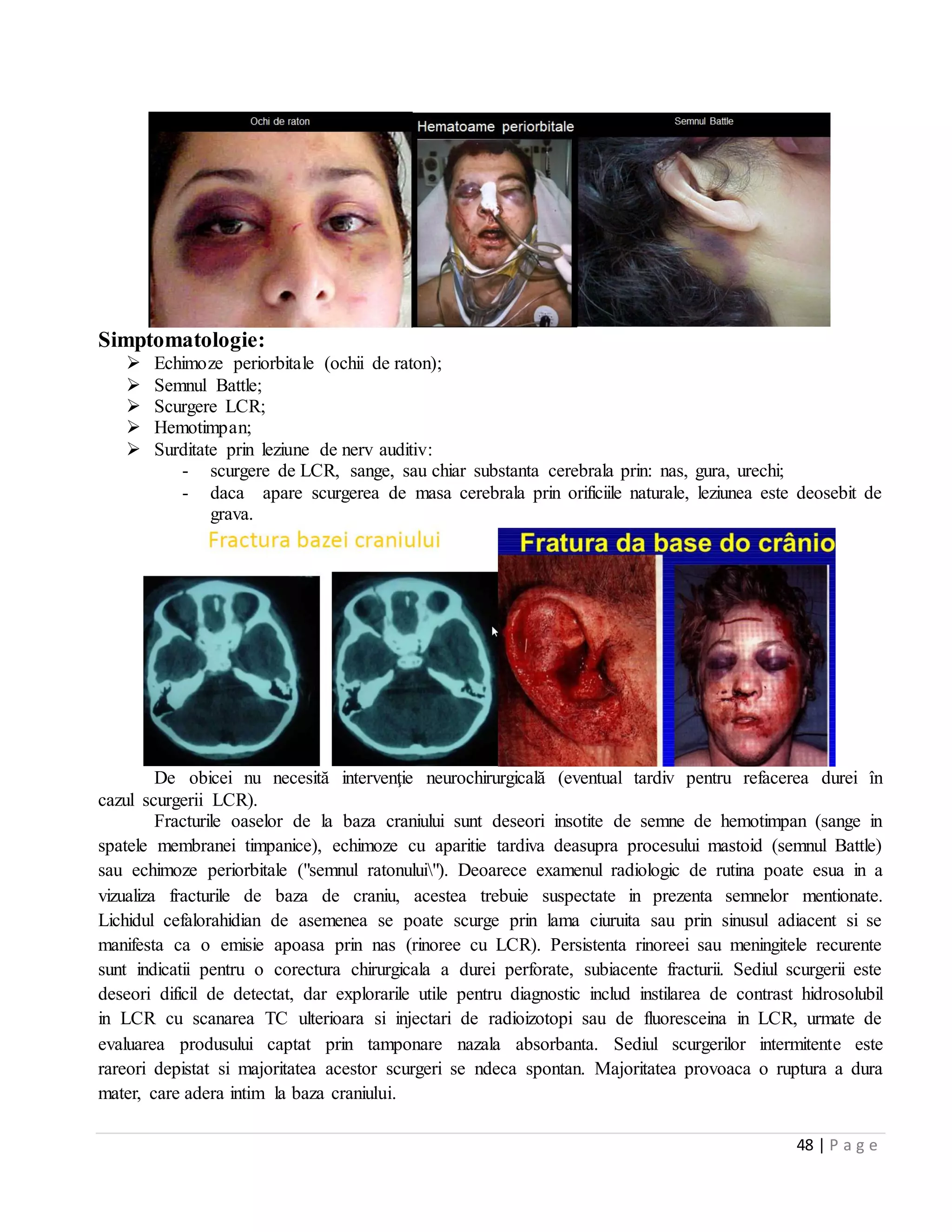 Traumatismele craniocerebrale si vertebromedulare | PDF