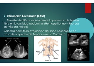 TRAUMATISMO-DE-ABDOMEN-Y-PELVIS.pdf