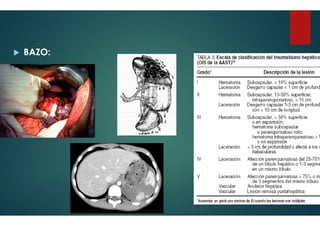 TRAUMATISMO-DE-ABDOMEN-Y-PELVIS.pdf