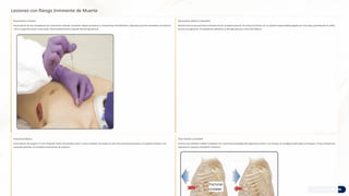 Guía Completa para el Diagnóstico y Manejo del Traumatismo Torácico en ...