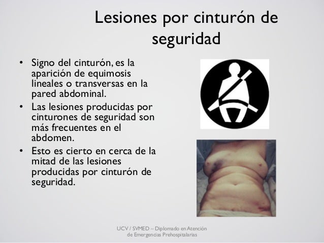 Traumatismo abdominal
