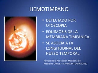 Traumatismo craneoencefalico | PPTX