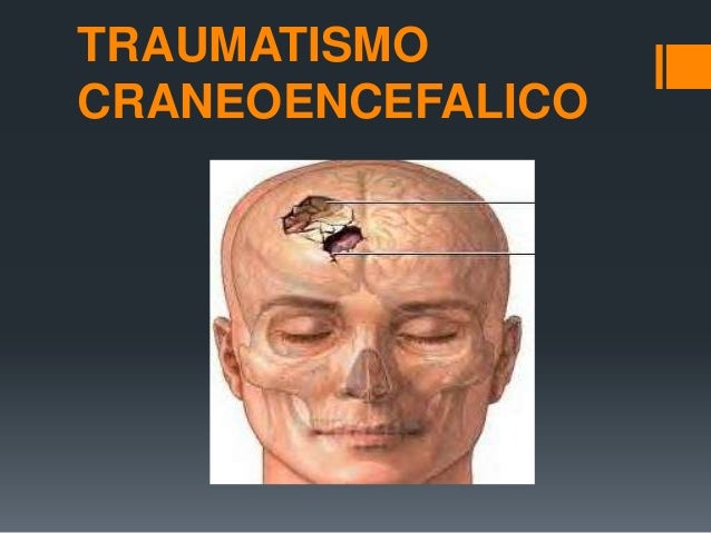 Traumatismo craneoencefalico