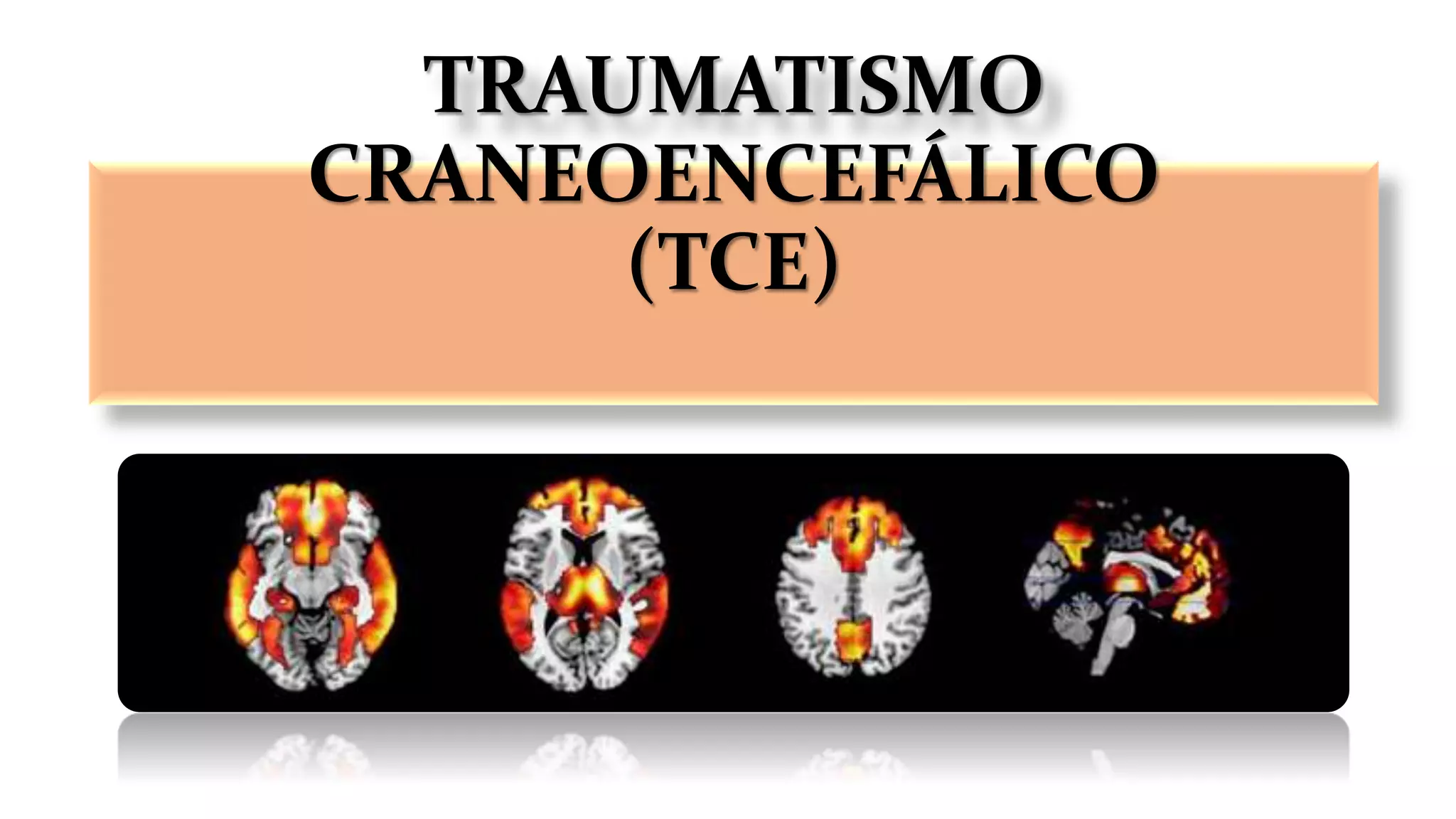 Traumatismo craneoencefálico (TCE) | PPTX
