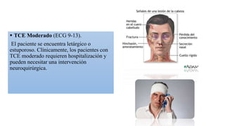 Traumatismo craneoencefálico (TCE) | PPTX