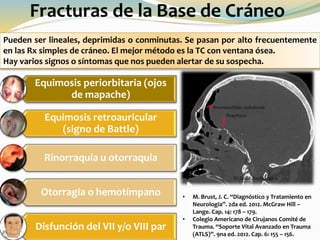 Traumatismo craneoencefálico | PPTX