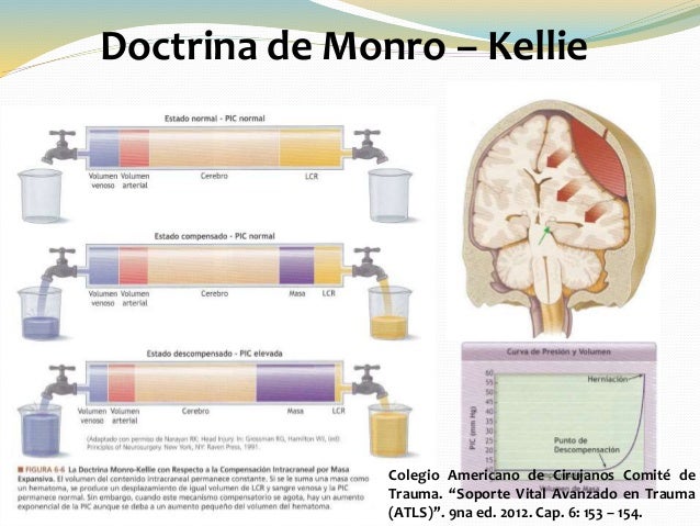 Traumatismo Craneoencefálico