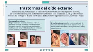 TRAUMATISMO DEL OÍDO. Otorringologia .pptx