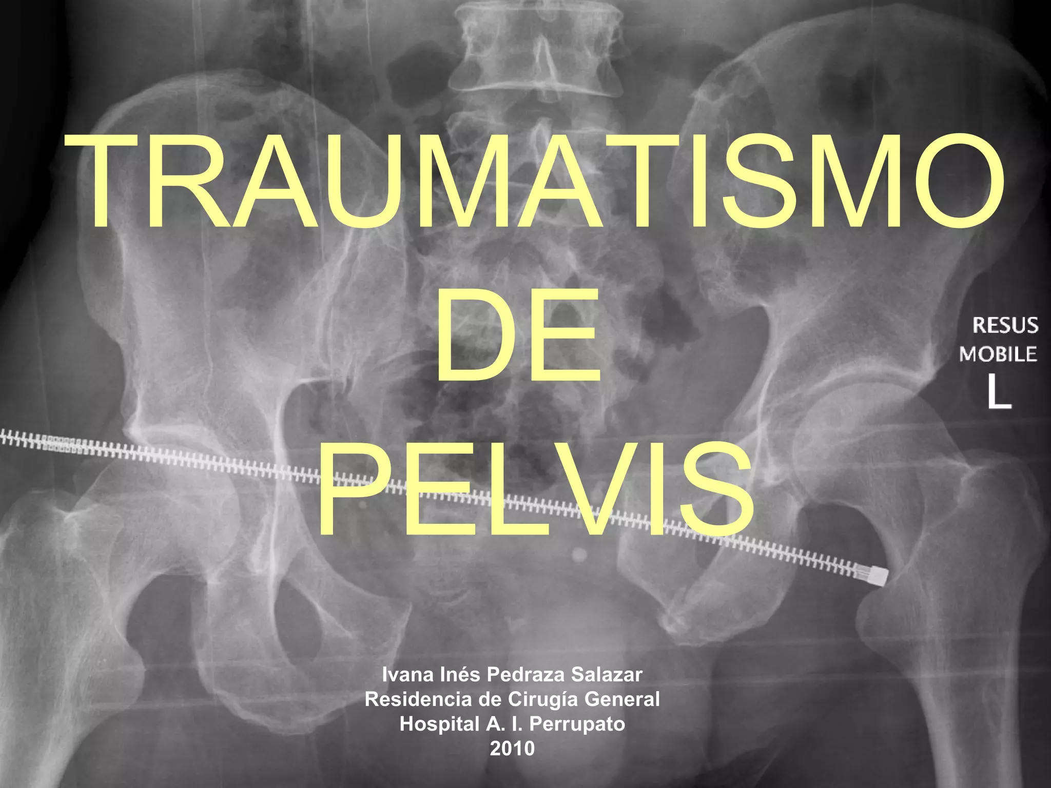 Traumatismo de pelvis | PPT