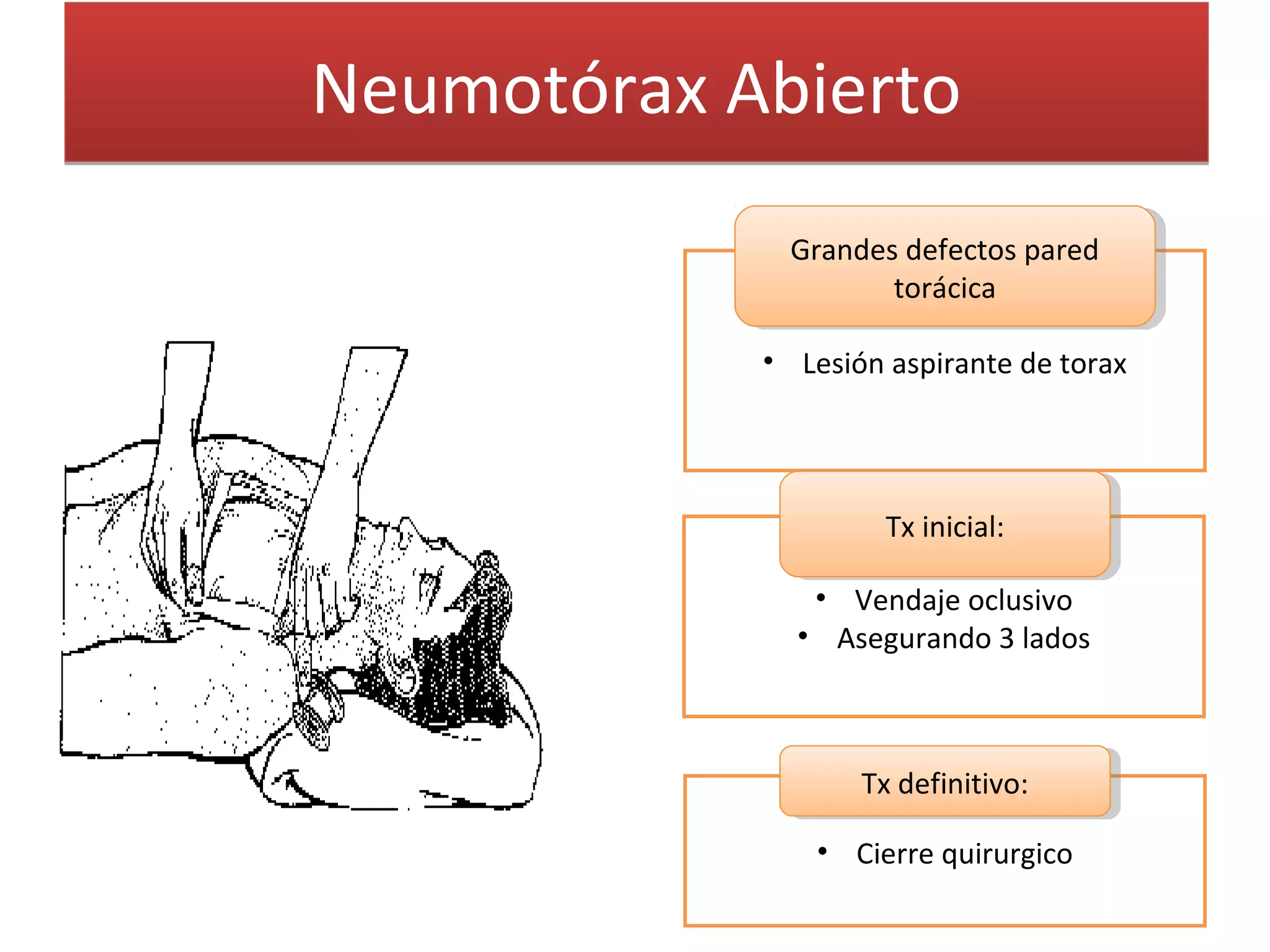 Traumatismo de torax Cirugia | PPT