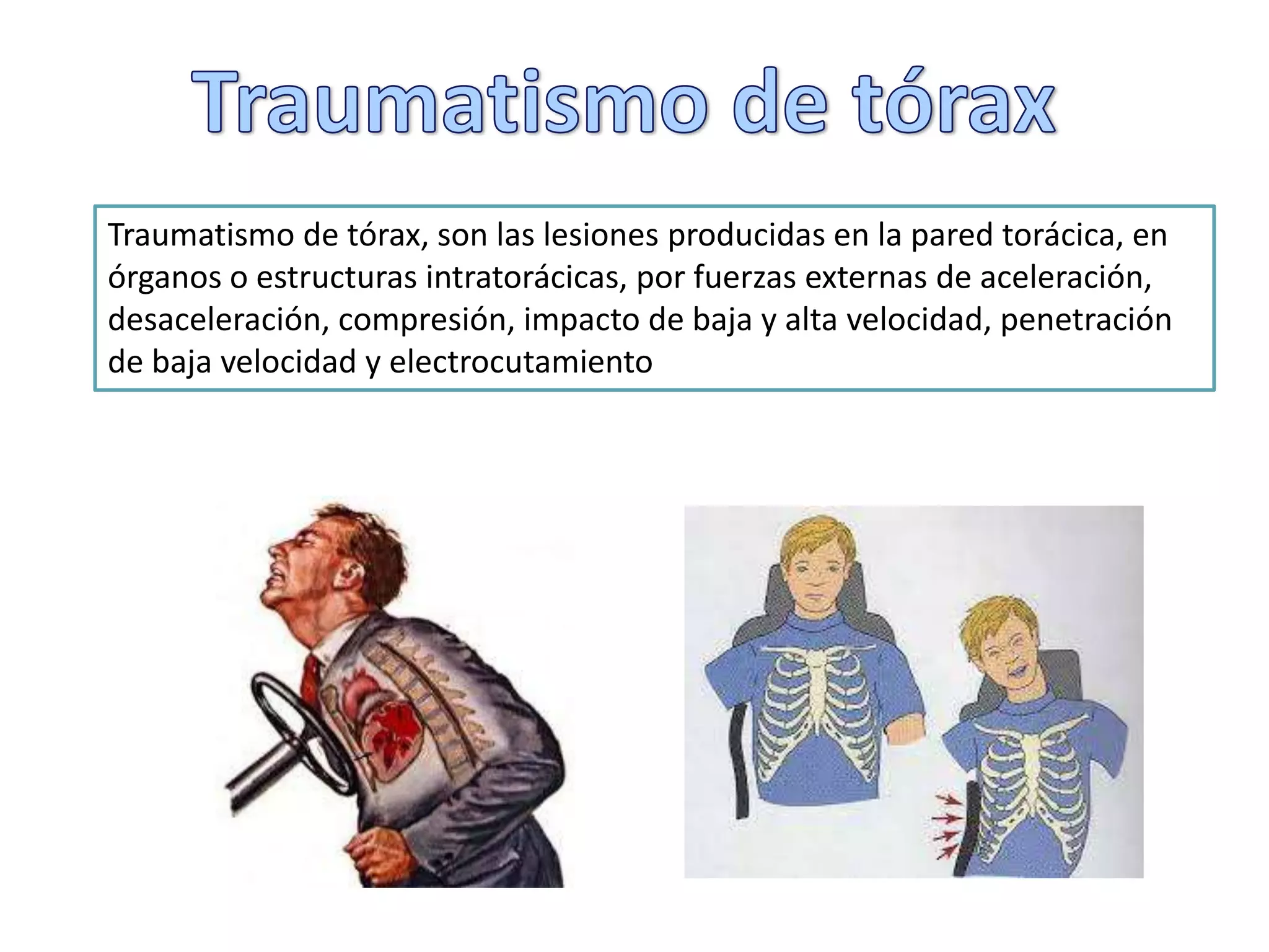 Traumatismo de torax | PPTX