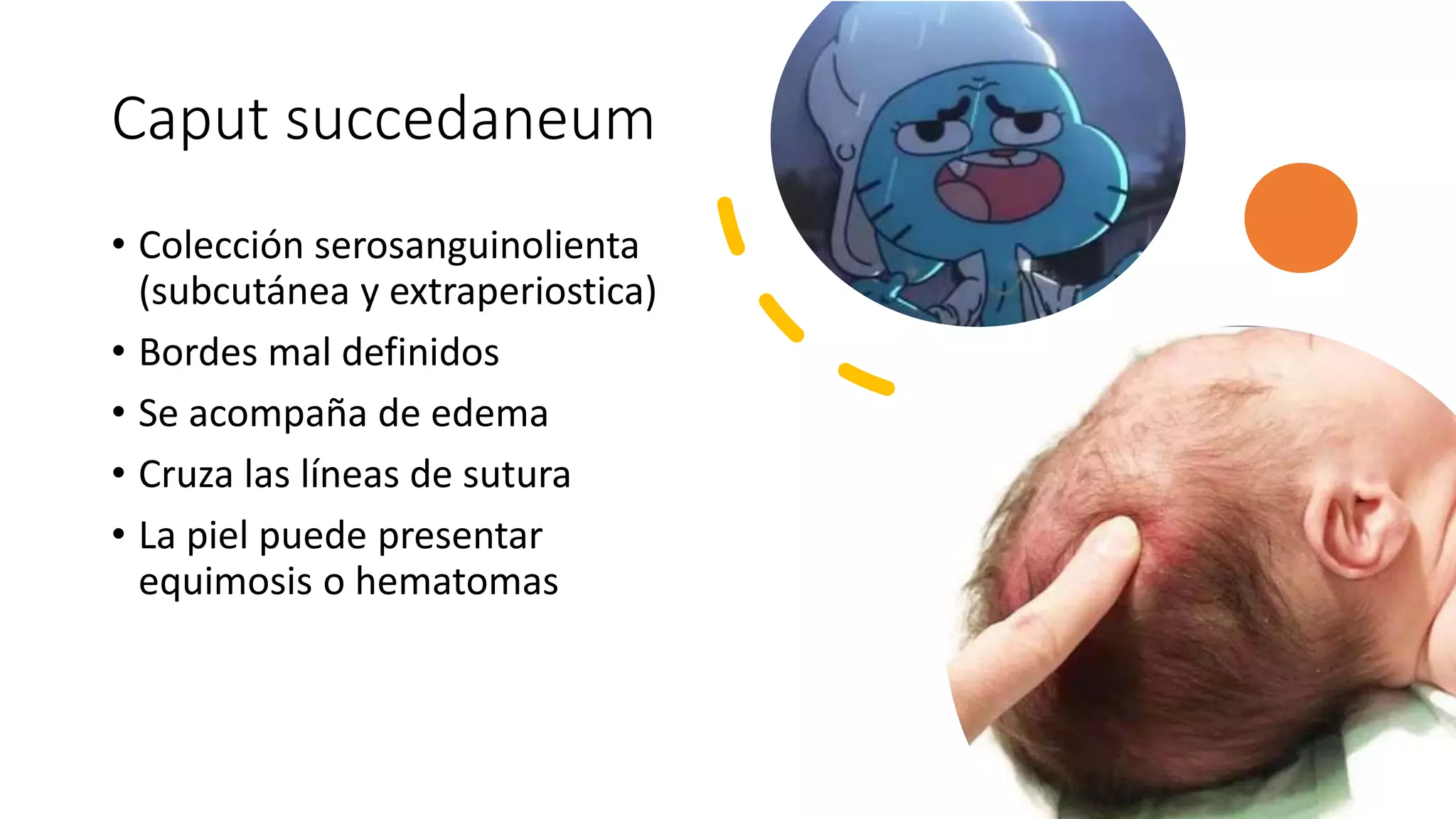 traumatismo durante el parto.pptx