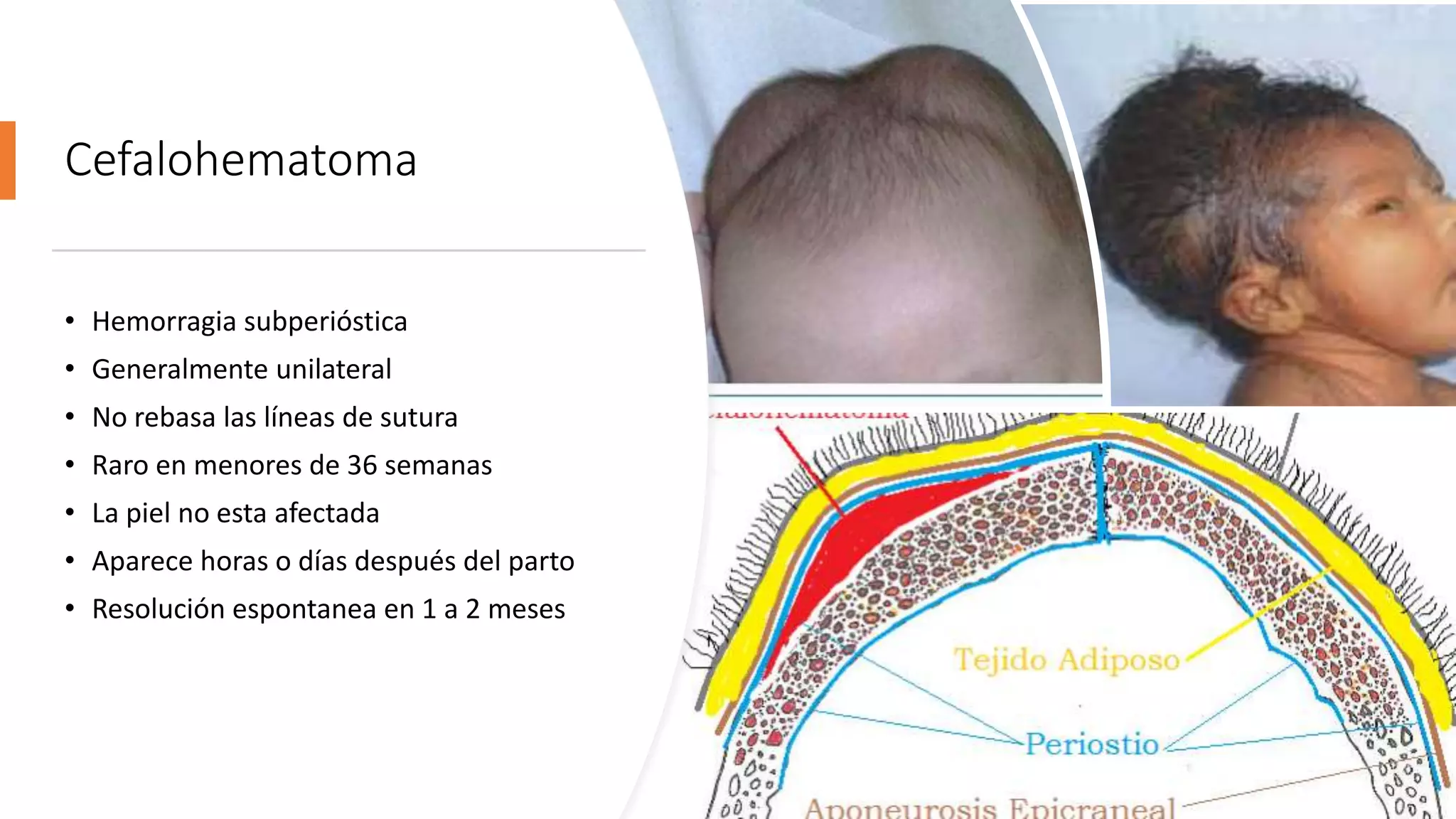 traumatismo durante el parto.pptx