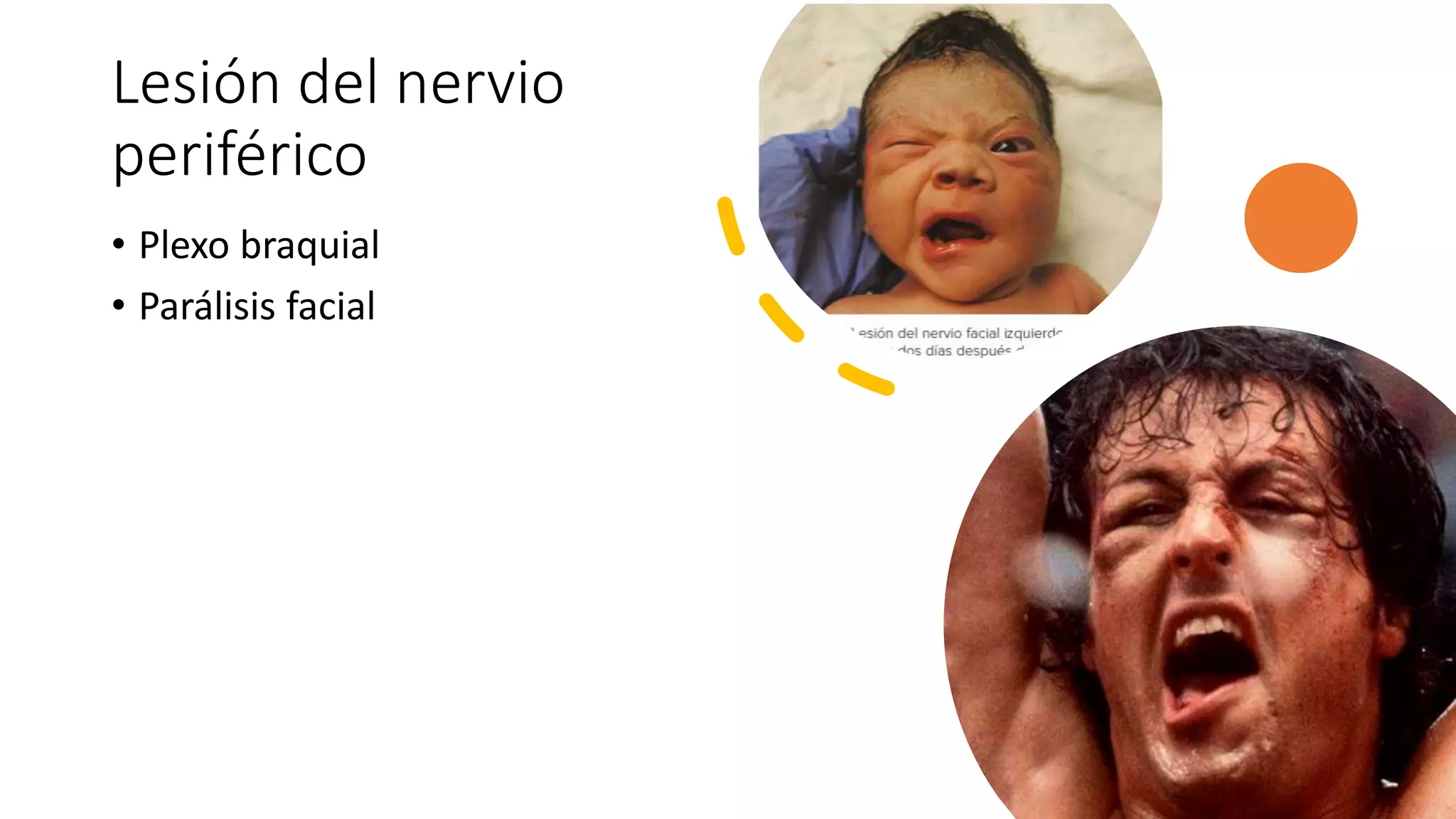 traumatismo durante el parto.pptx