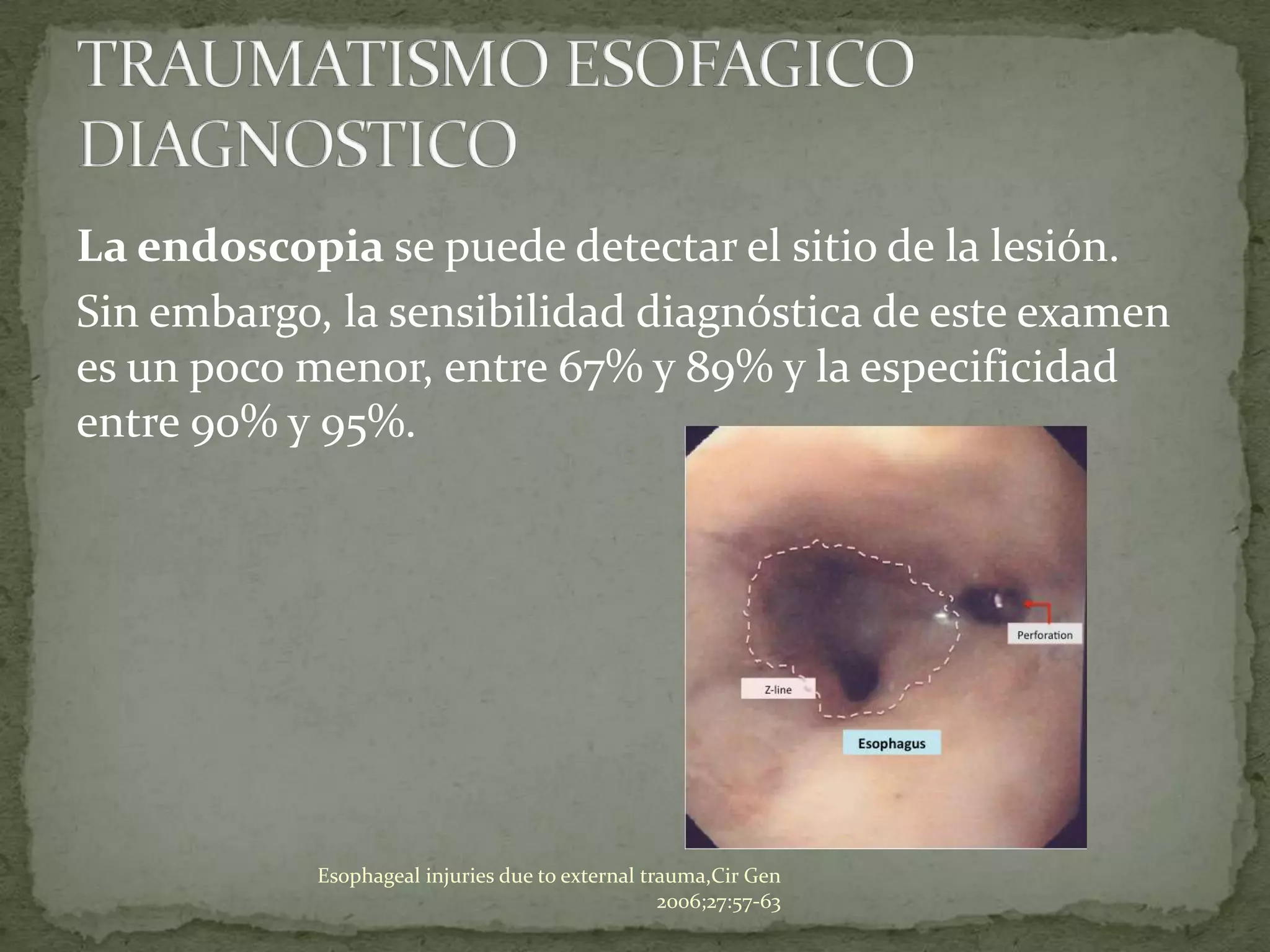 Traumatismo esofagico | PPT