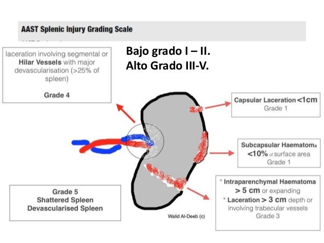 Traumatismo esplenico